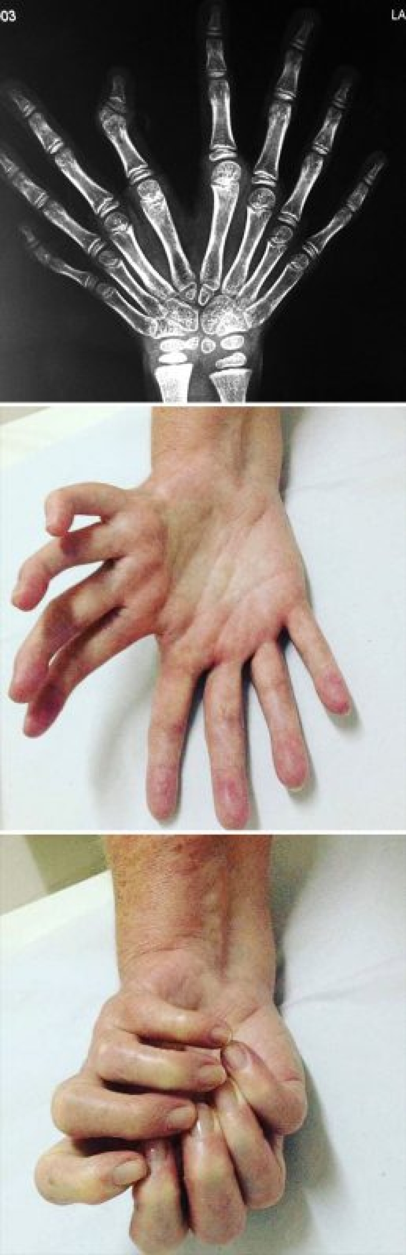 Interesting genetics: 30 people with a rare anomalies - Pictolic