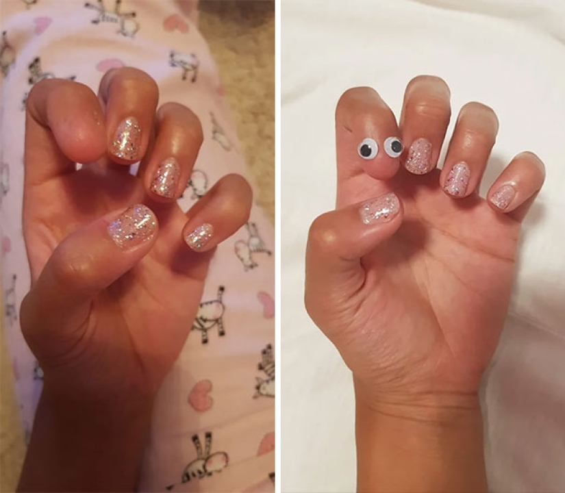 Interesting genetics: 30 people with a rare anomalies - Pictolic