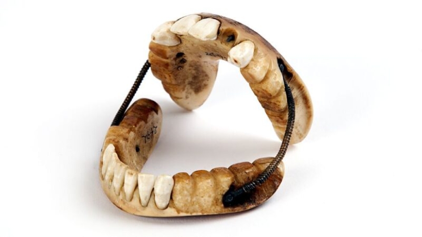 What is "Waterloo teeth", or As the battle of 1815 influenced the ...