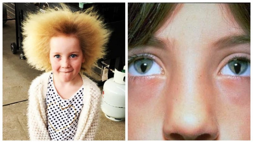 8 anomalies that demonstrate how unpredictable genetics - Pictolic