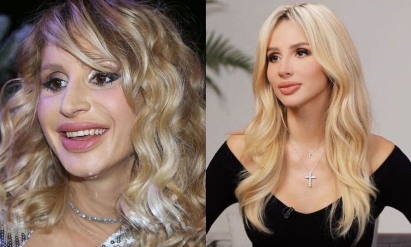 Hacerse una cirugía plástica fue la mejor decisión: 10 transformaciones milagrosas de estrellas ...