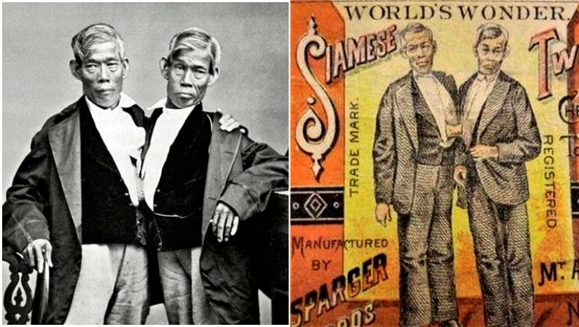 Chang and Eng Bunker: The Story of the Brothers Who Created the Concept of 'Siamese Twins ...
