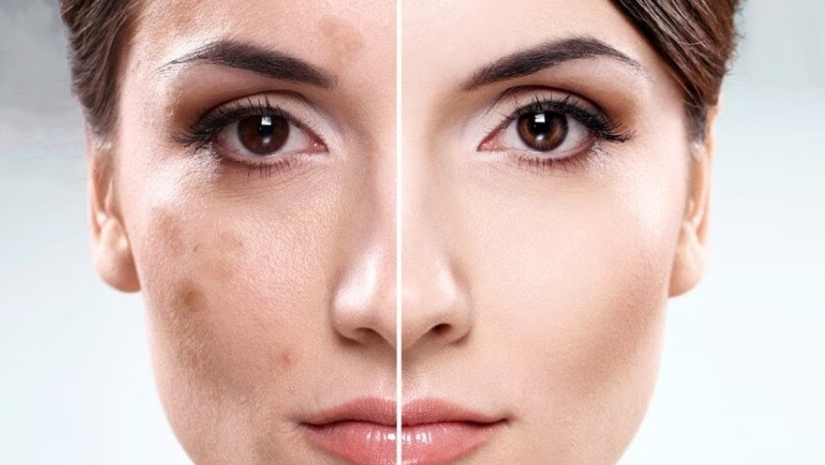 The result is obvious: as computers and smartphones spoil your skin ...